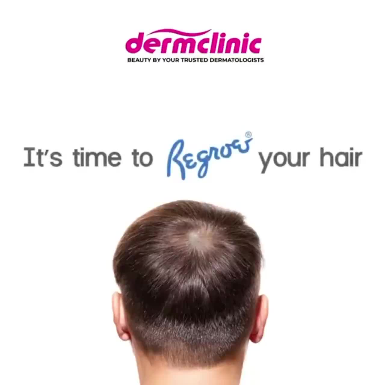 Regroe Minoxidil 5% 60mL | Shopee Philippines