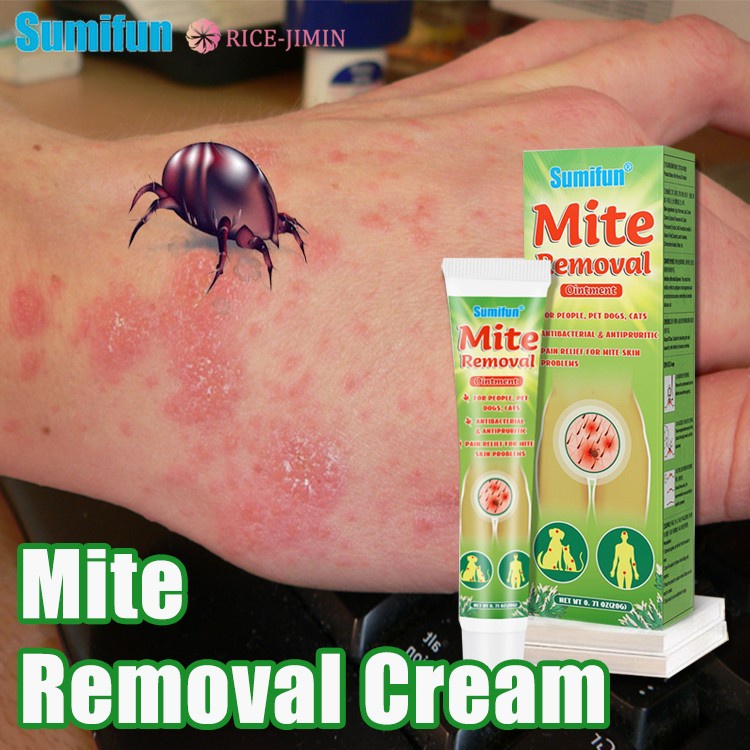 【Ship Today】 Mites Removal Ointment Cream Lice Natural Anti Mites ...