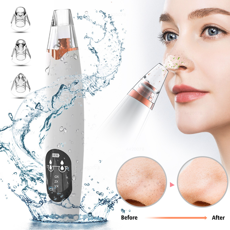 Blackhead Remover Face Skin Care Pore Vacuum Acne Pimple Removal ...