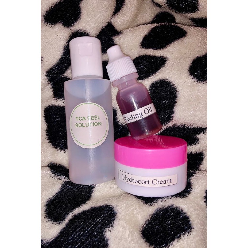 TCA Skin Peeling Solution Set 10% 60ml 10g, hydrocort cream and 20ml ...