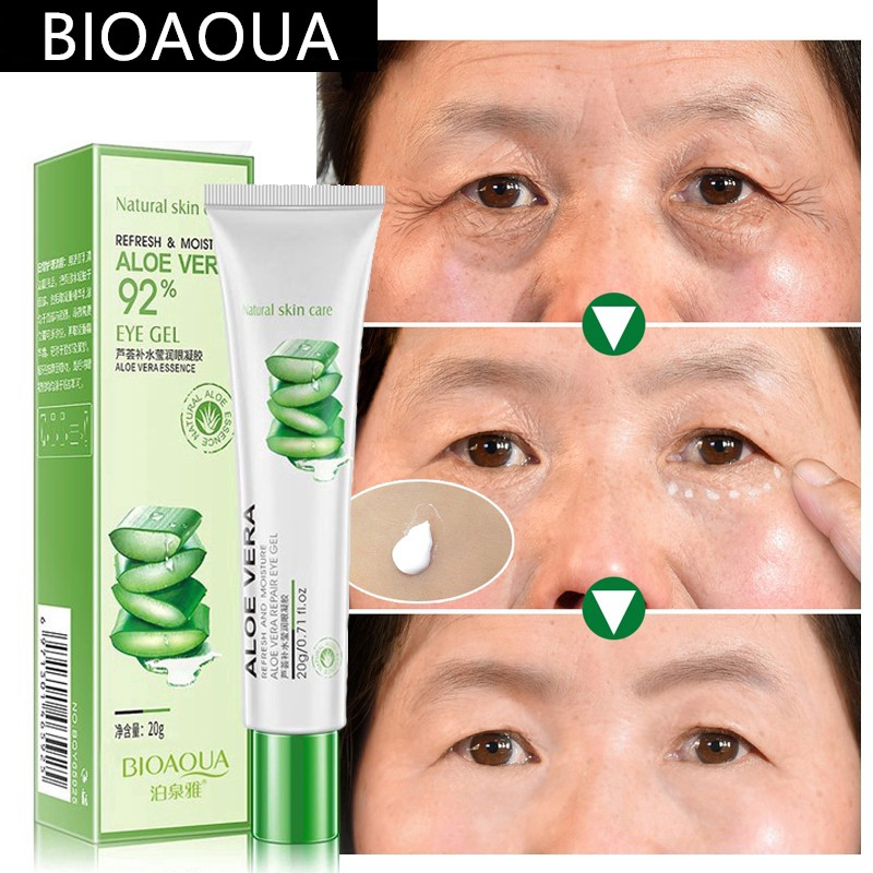 Aloe Vera Eye Cream Moisturizing and Removing Darkcircles Removing Eye ...