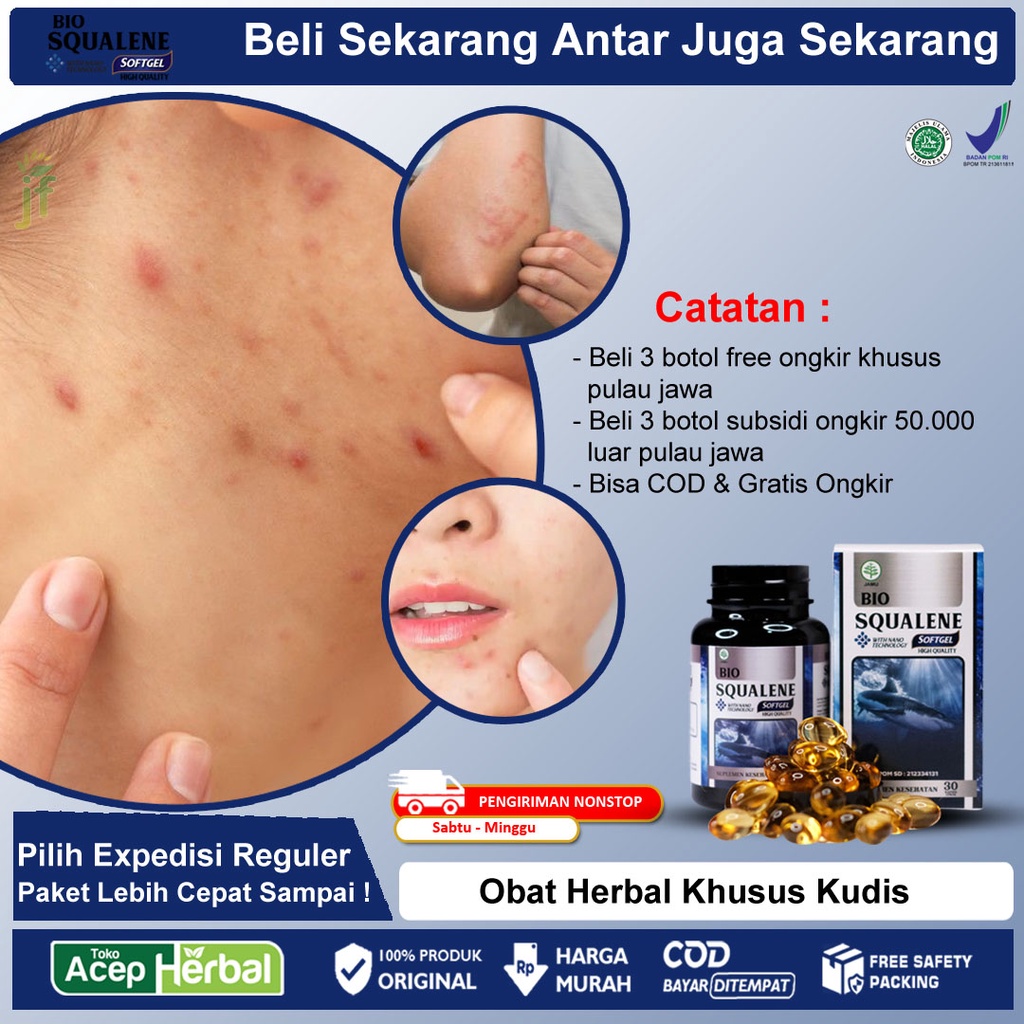 Medicine For Scabies Ringworm Scabies Skin Infection Budug Bisul Butt ...