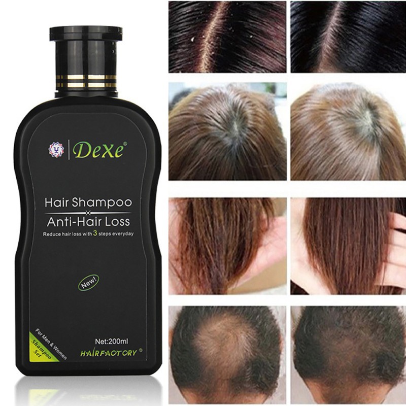 200ml Hair Shampoo Set Anti-hair Loss Chinese Herbal | Shopee Philippines