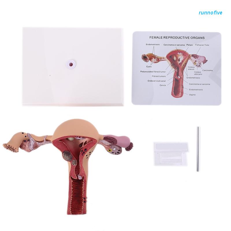 cozy Human Female Uterus Ovary Disease Dissection Pathology Model Biology Teaching Aids Anatomy ...