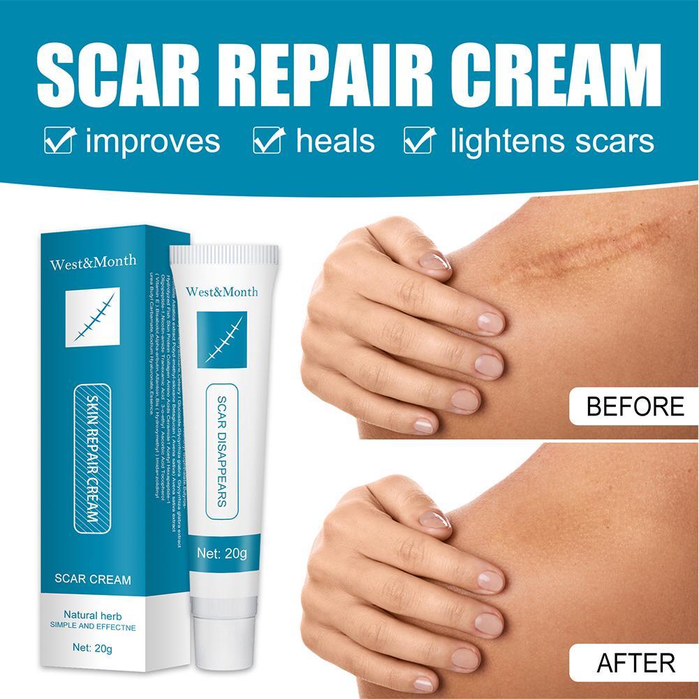 Seebee 20g Repair Cream Scars Fade Burns Burns Old Scars Acne Marks ...