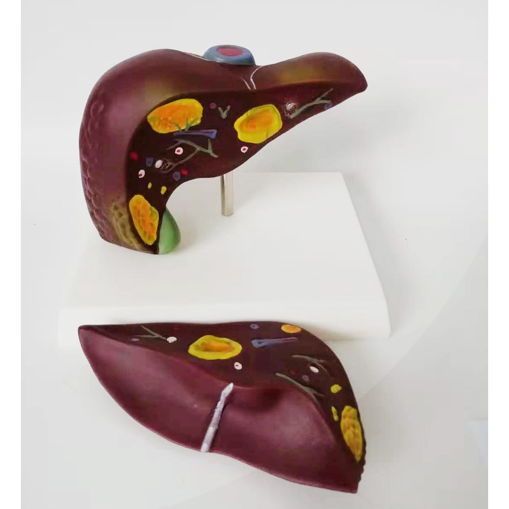 liver structure model liver anatomy medical teaching aid | Shopee ...