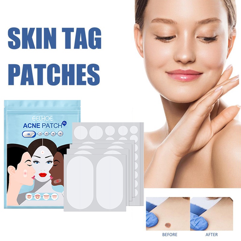 Invisible Acne Anti-inflammatory Patches / Multi-sized Pimple Healing ...