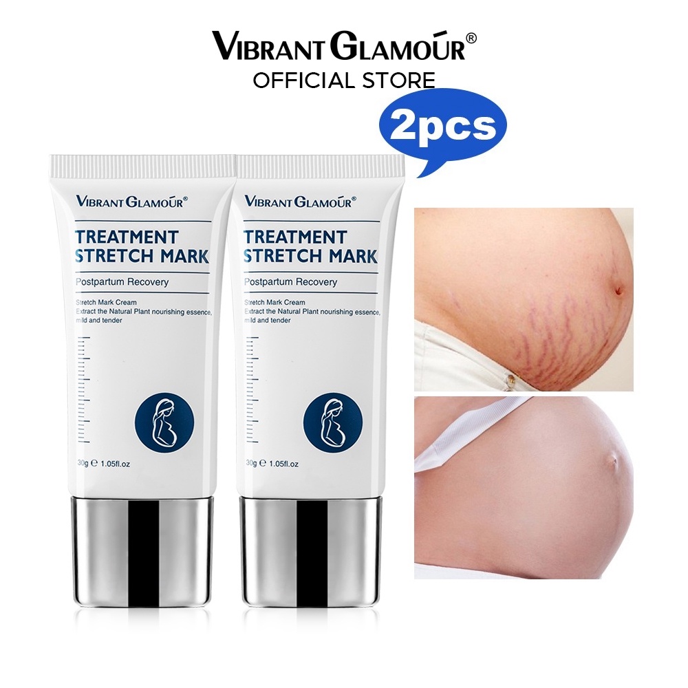 VIBRANT GLAMOUR Stretch Marks Remover Cream 2 Pcs Set Body Care 30g*2 ...