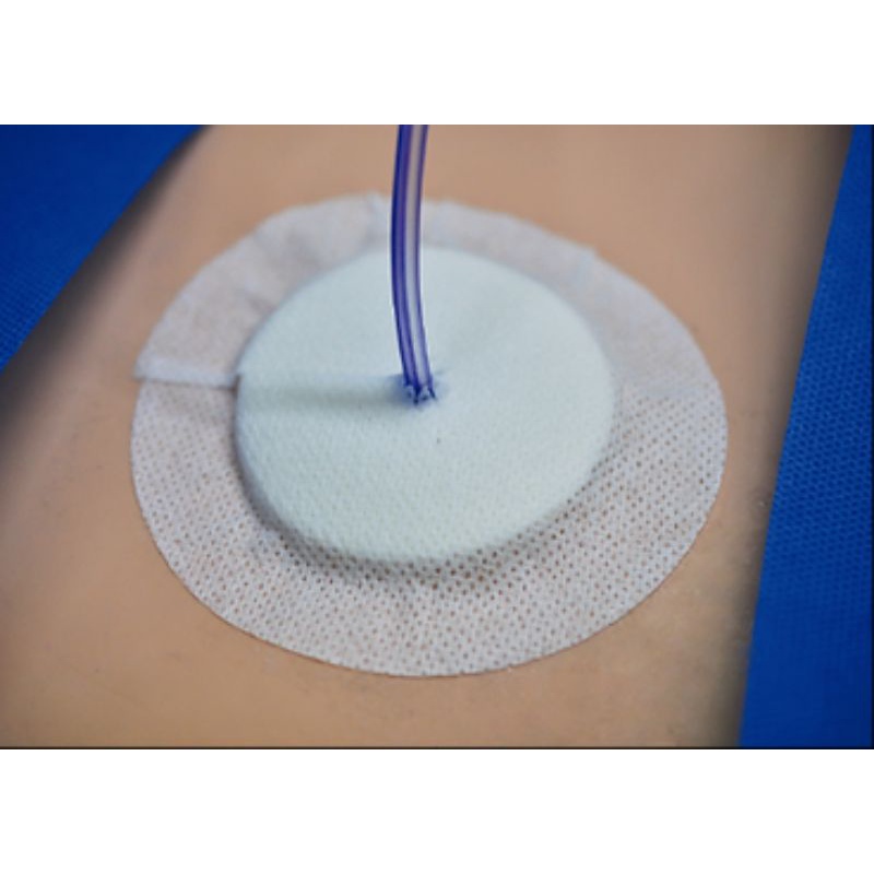 Cath Dressing (Drainage Tube Dressing) | Shopee Philippines