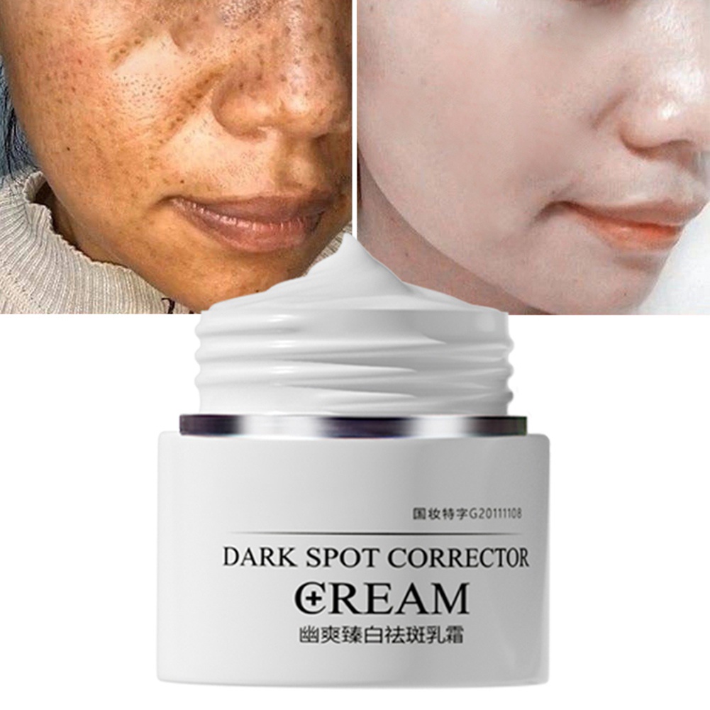 Pumpup-Yoxier Freckle Removal Cream Dark Spot Corrector Face Whitening Freckle Cream 30g ...