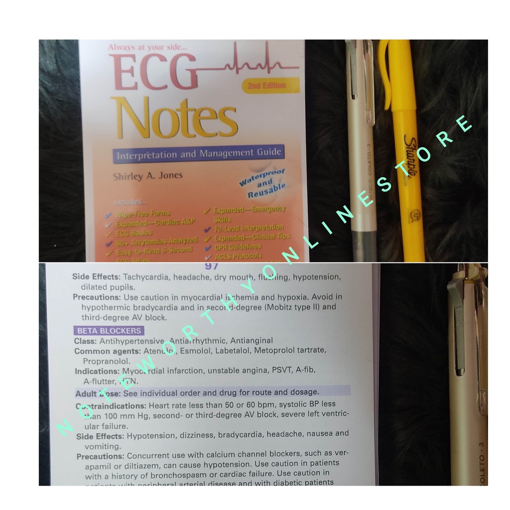 FA Davis Medicine Student's ECG Notes PLE Review Flashcards | Shopee ...