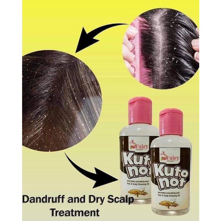 KutoNot Pampatangal kuto kasama pati Lisa ORIGINAL Ready to Ship Lice ...