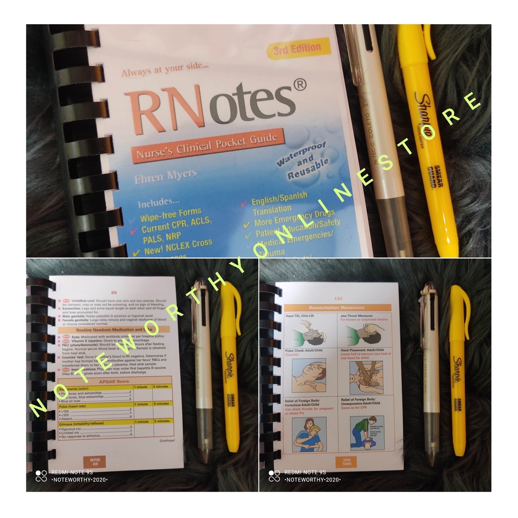 FA Davis Nursing PNLE NCLEX RNotes Flashcards | Shopee Philippines