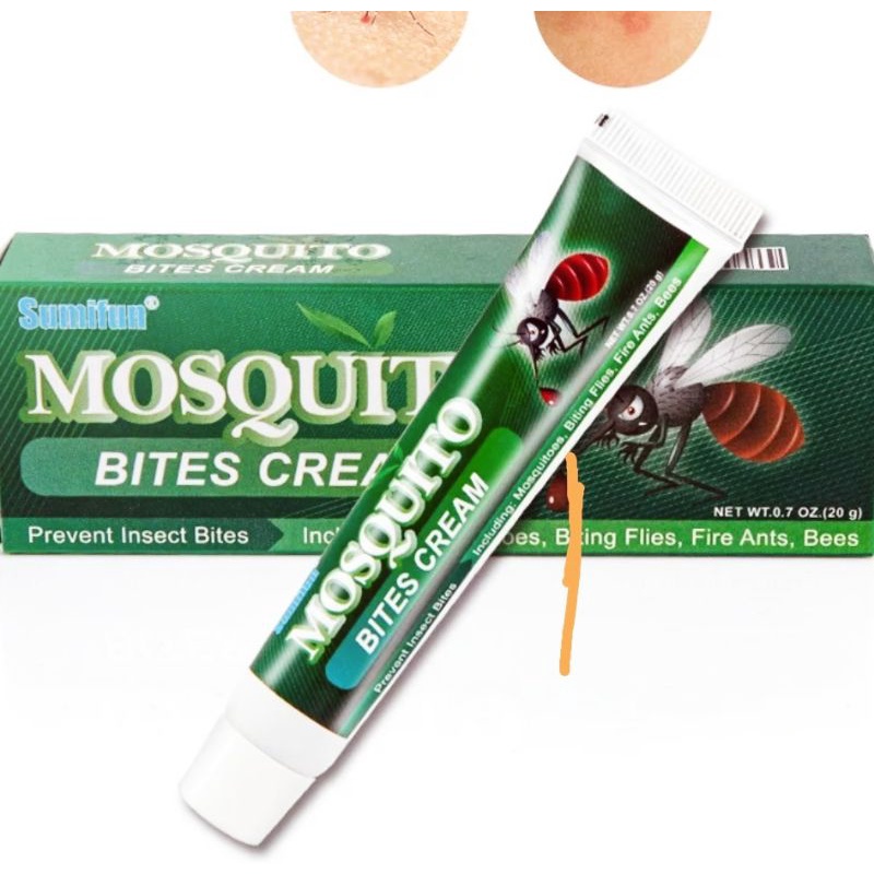 Mosquito bite cream 20g | Shopee Philippines