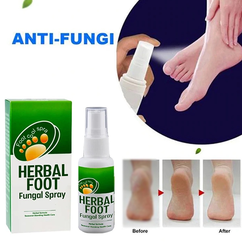 30g Herbal Anti-fungal Athlete Foot Spray Antibacterial Deodorant ...