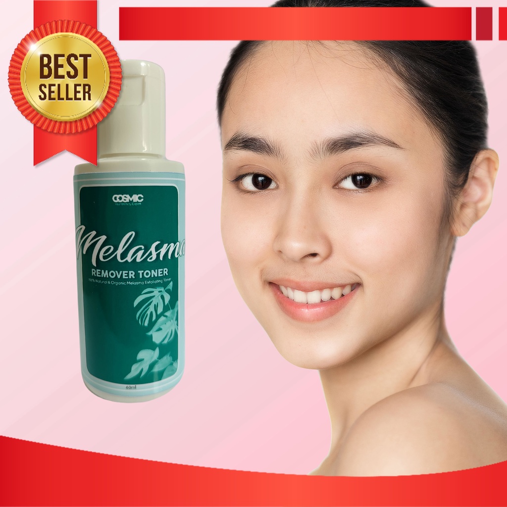 MELASMA REMOVER TONER FOR WHITENING (REPAIR, WHITENING AND PEKAS ...