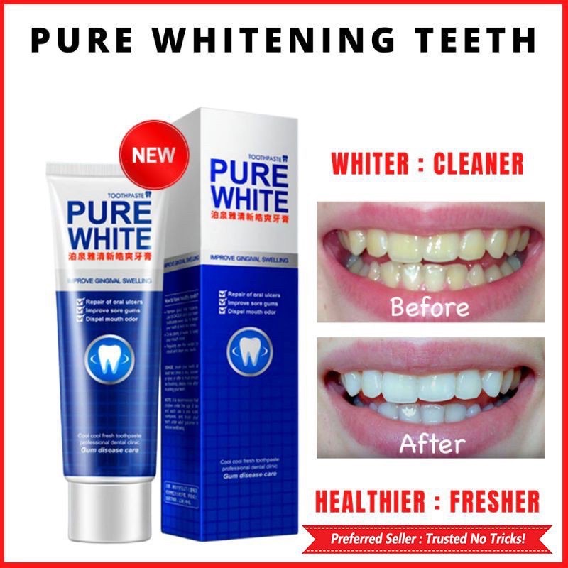 Original BIOAQUA PURE WHITE TOOTHPASTE in FRESH MINT - 120G | Shopee ...