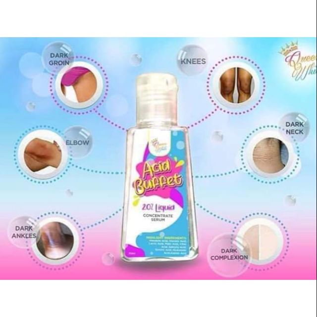 Queen White Acid Buffet | Shopee Philippines