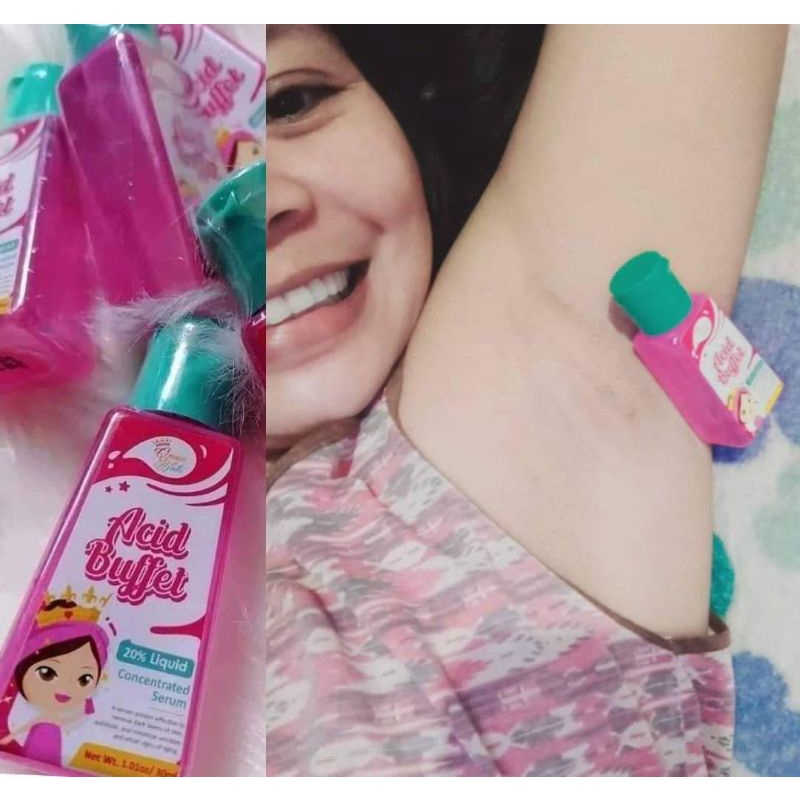 100%LEGIT Queen White acid buffet serum 30ml | Shopee Philippines
