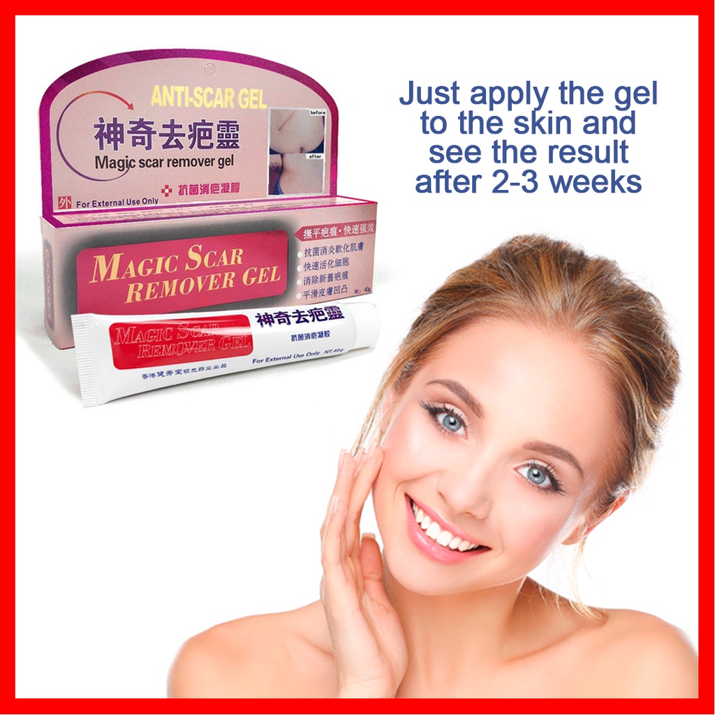 Scar Remover Effective Magic Scar Mabisang pangtanggal PEKLAT/KELOIDS ...