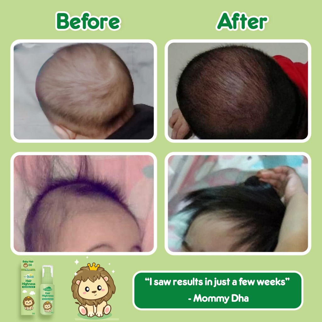 Tiny Buds Hair Highness Natural Baby Hair Oil 50ml | Shopee Philippines