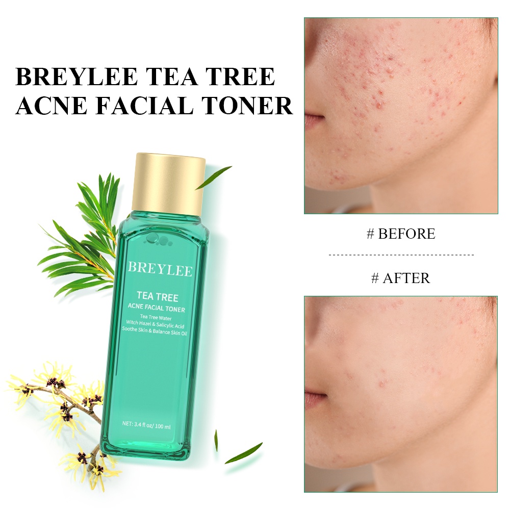 BREYLEE Tea Tree Acne Treatment Toner， Skin Deep HydrationRepair The ...