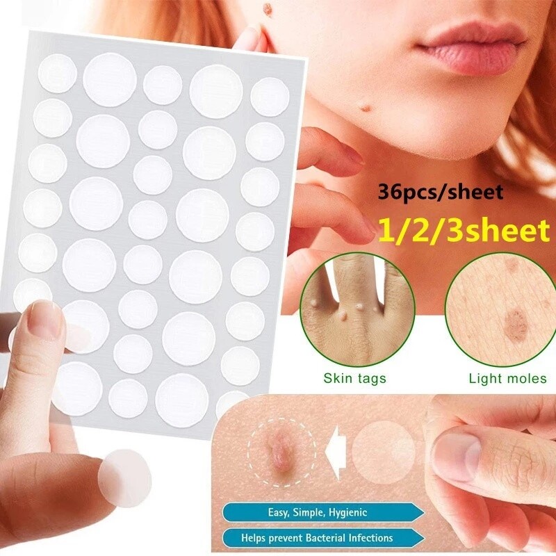 36Pcs Skin Tag Remover Patch Pimple Freckle Wart Treatment Cream Quick ...