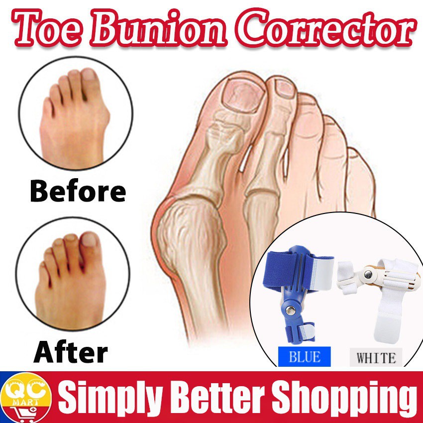 Bunion Device Corrector Hallux Valgus Orthopedic Braces Big Toe ...