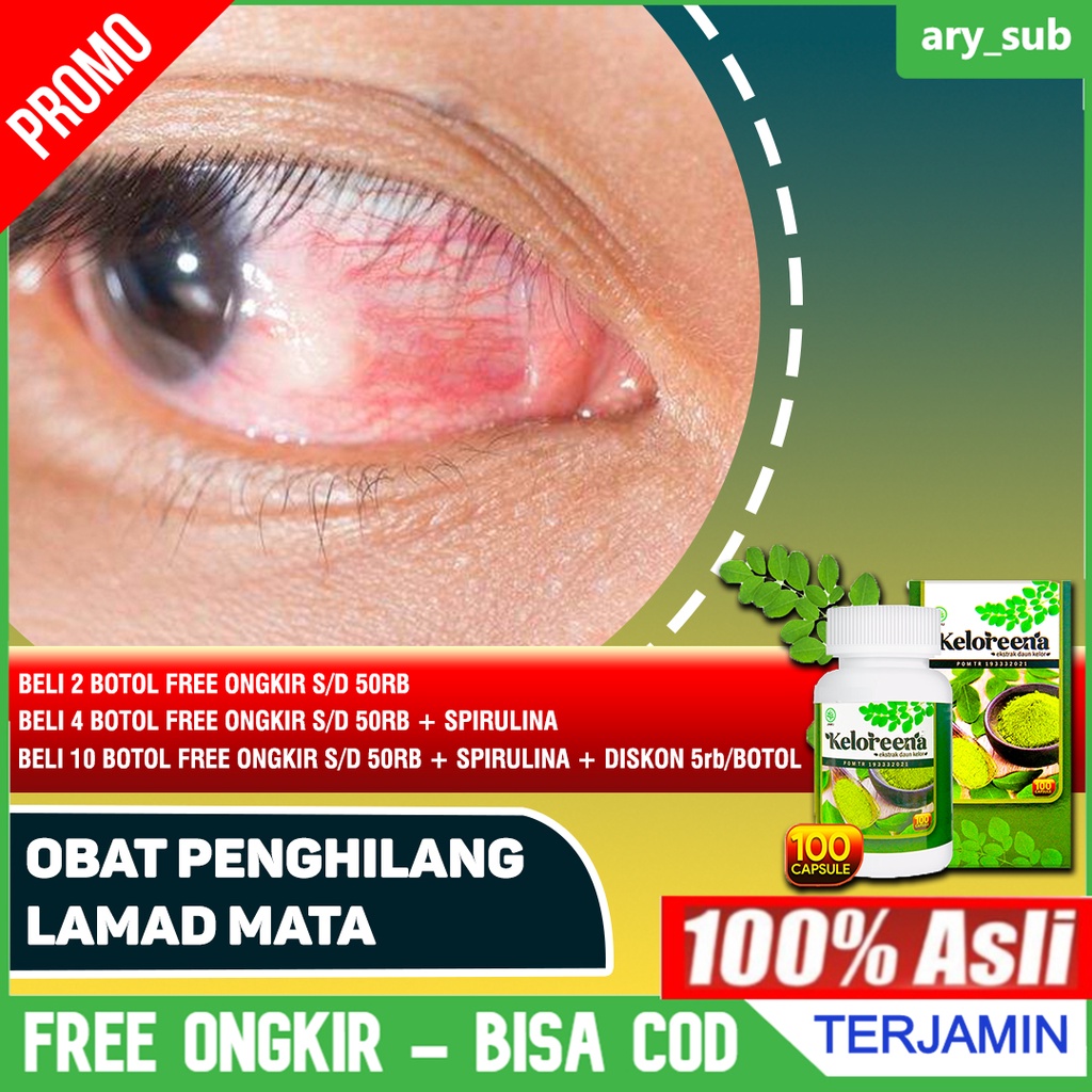 MATA Medication to Remove Old Eyes, Fatty Eyes, Pterygium Eyes ...