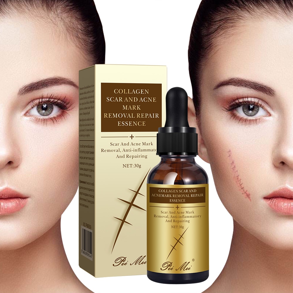 Scar Removal Serum Safe effective scar remover surgical stretch marks ...
