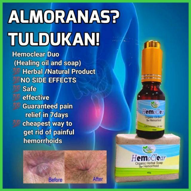HEMOCLEAR SET SOAP & OIL (Organic Treatment For Hemorrhoids) | Shopee ...