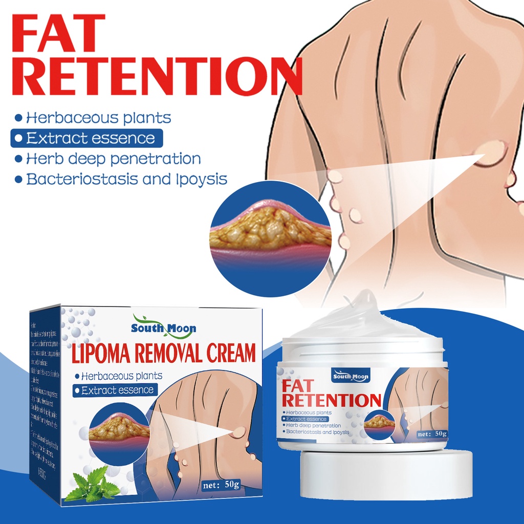 South Moon Fat Nodule Cream to Relieve Fat Lumps, Bulging and Tumor ...