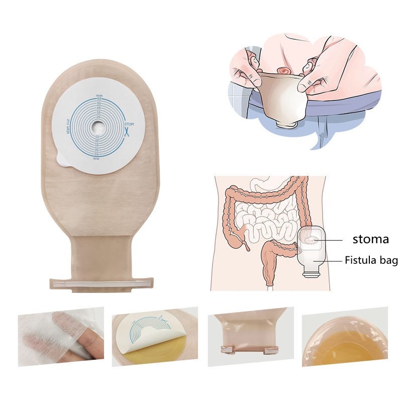 10 Pieces Colostomy Bag Medical Type Seal Ostomy Bag Surgical Bag