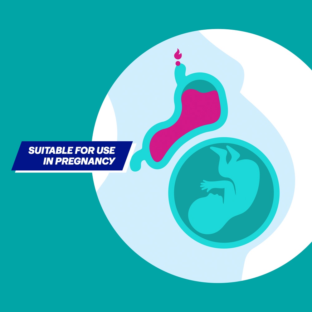 Gaviscon Original Antacid Chewable Tablet 250mg Pack of 8s for Acid ...