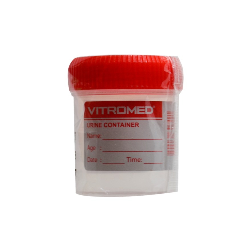 VITROMED Urine Container | Shopee Philippines