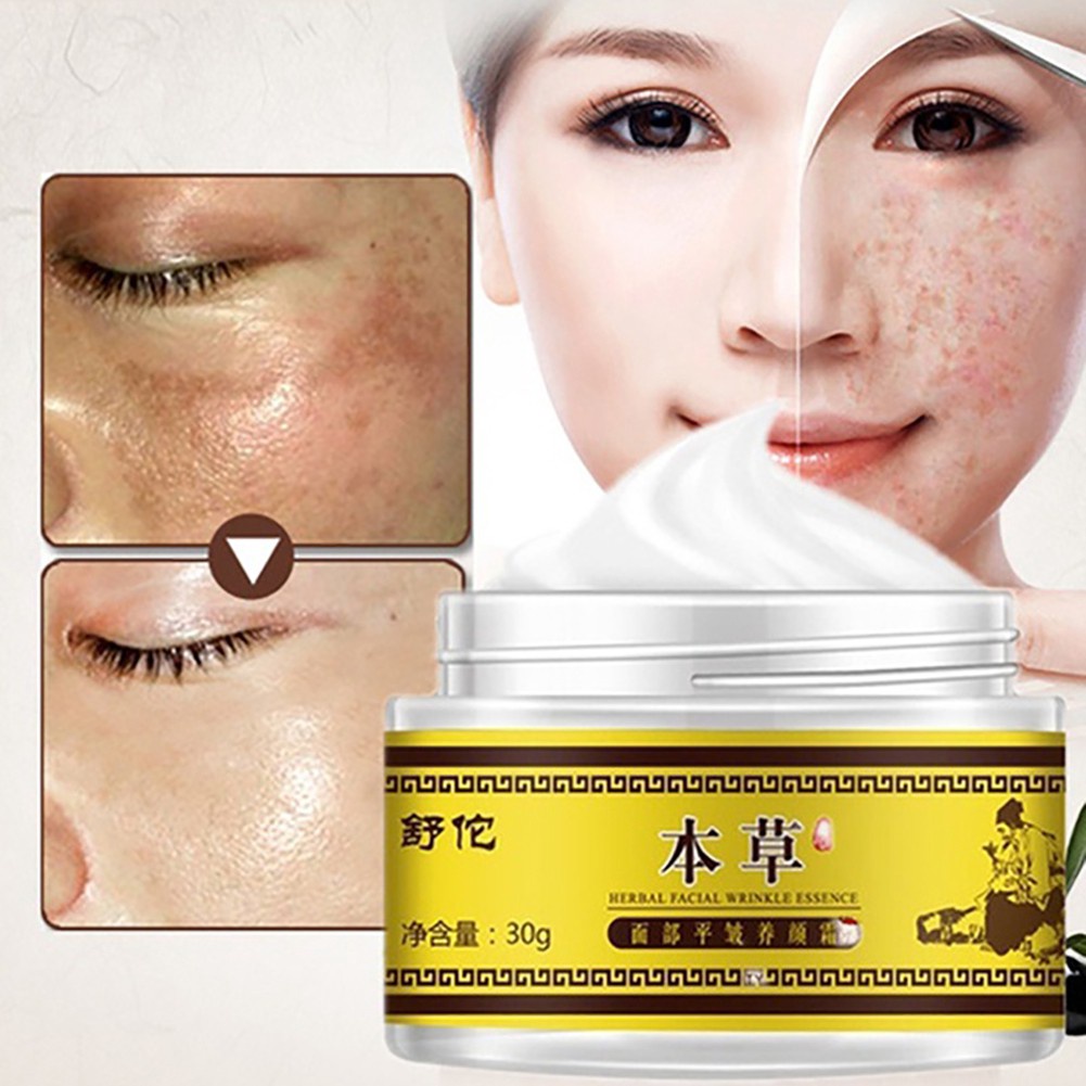 Dark Spot Freckle Removal Cream Brightening Whitening Cream Melasma ...