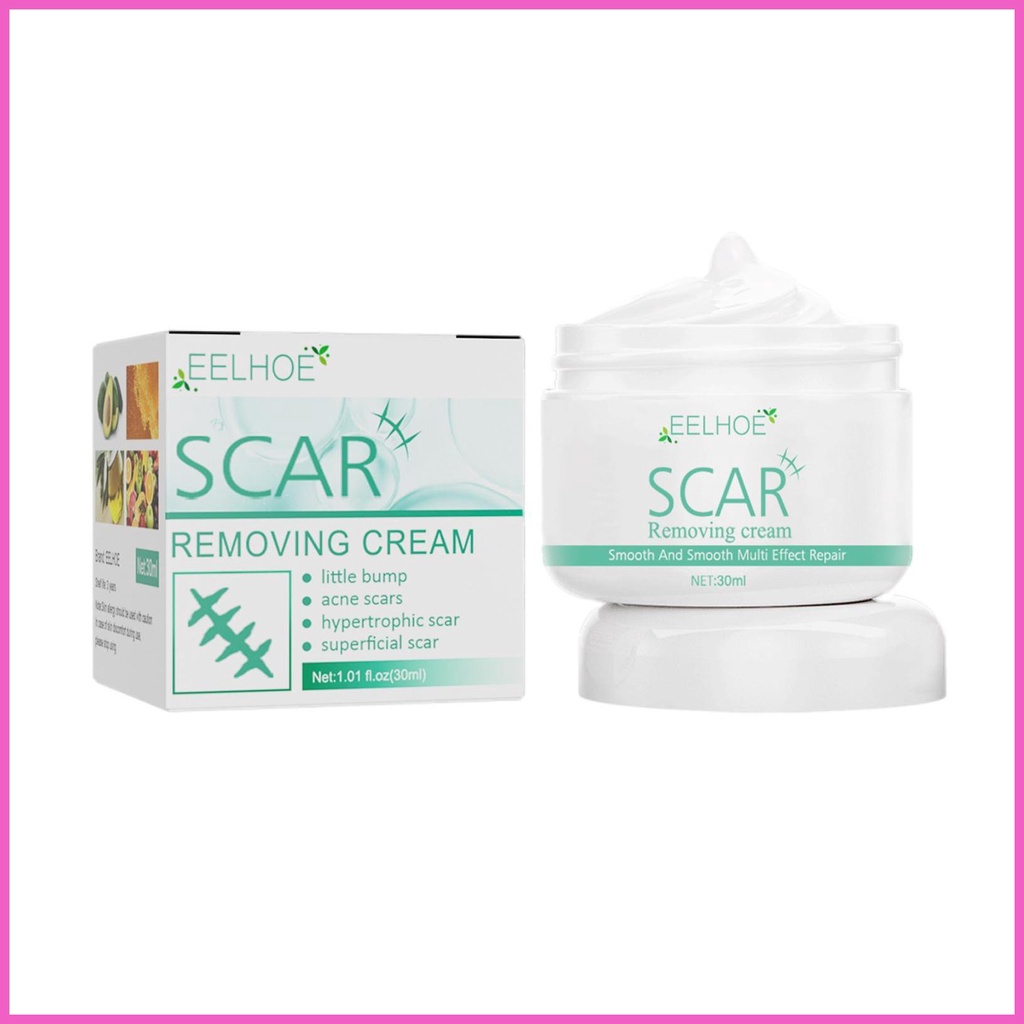 Stretch Mark Gone Cream Stretch Mark Removal Scar Repair Cream for ...