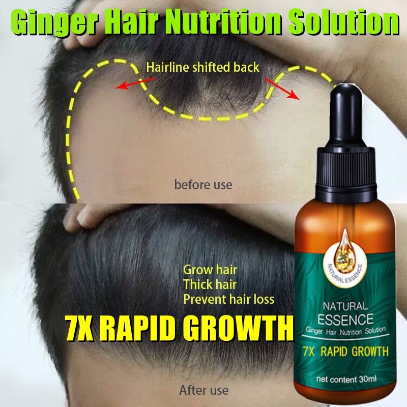 Ginger Hair Growth Essential Oil Rapid Hair Growth Serum Anti Hair Loss ...