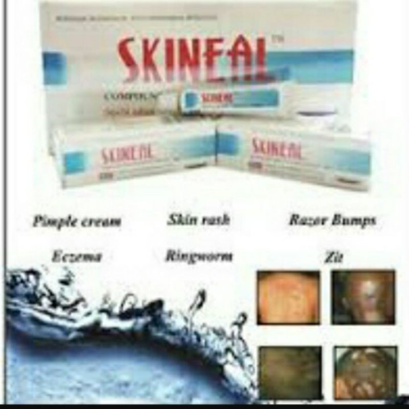 Skineal Antifungal Cream 15g | Shopee Philippines