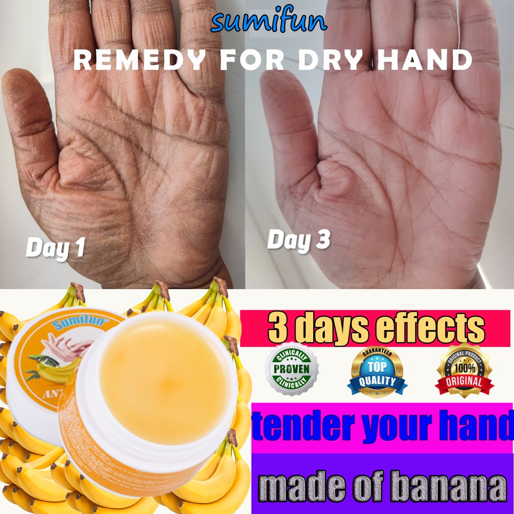 【In Stock】Hand Cream for Rough Hands,Anti Cracking，Chapping and ...