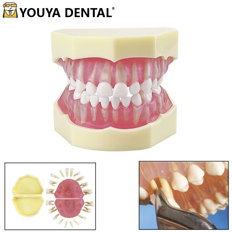 Kids Teeth Model For Training Practice Tooth Extraction Model Dental ...