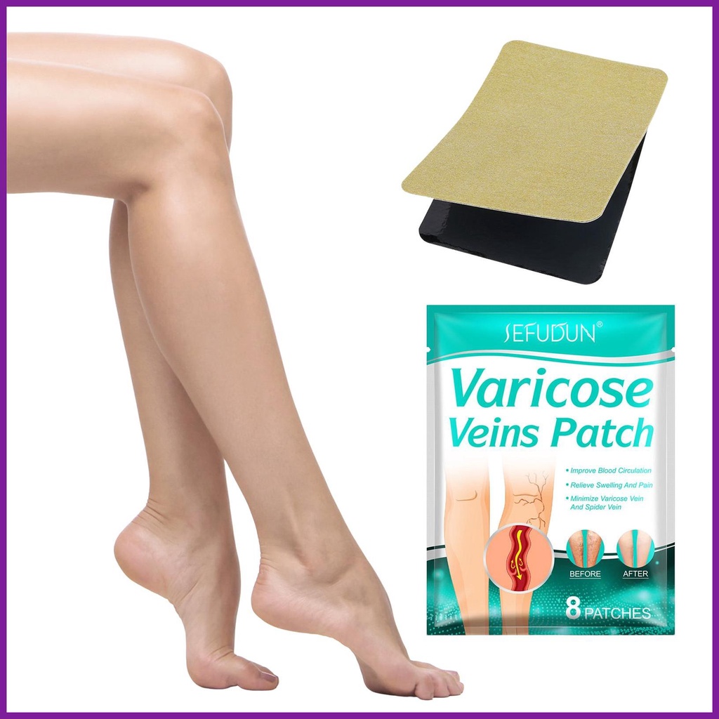 8pcs Varicose Veins Patch Relief Leg Vasculitis Spider Varicose Vein ...