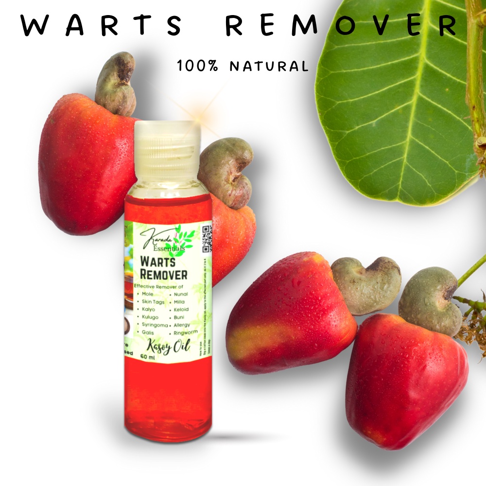 Warts fast remover kasoy oil Natural mole Skin Tag kulugo Nunal ...