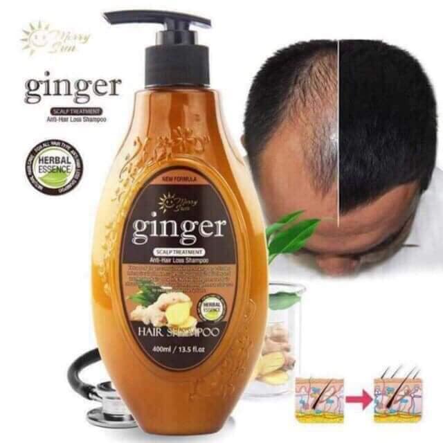 COD AUTHENTIC | MERRYSUN GINGER BOTTLE | SCALP TREATMENT | ANTI - HAIR ...