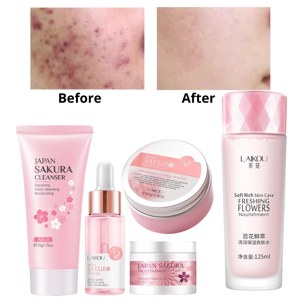 Japan Sakura Skin Care Set Whitening Set Exfoliating Shrink pores Acne ...