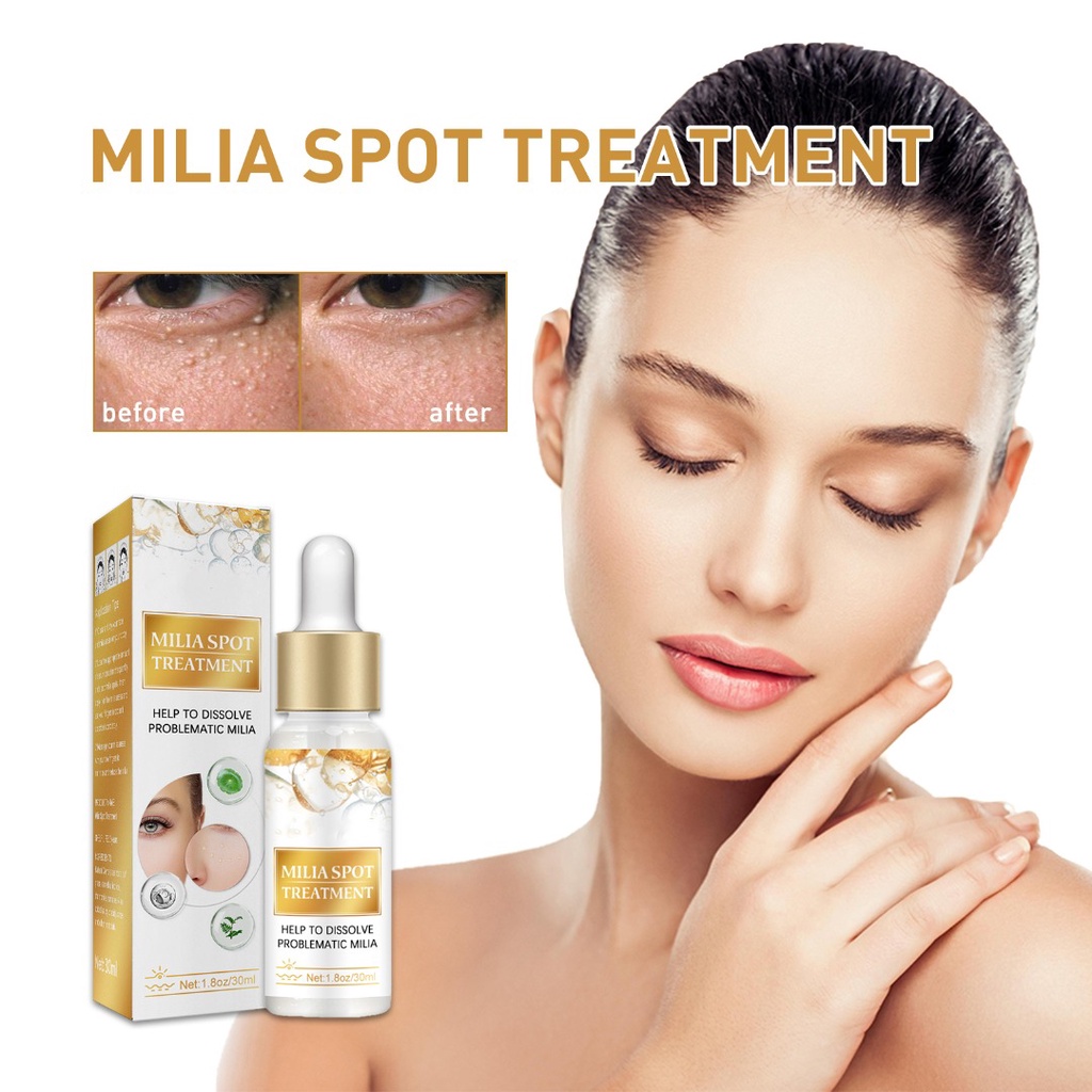 Milia Remover Essence Milia Spot Treatment Helps Dissolve And Reduce 1952