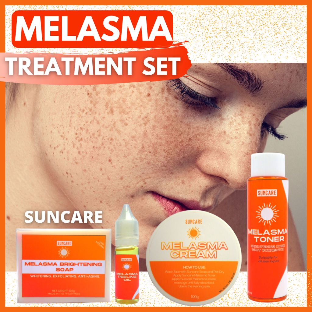 MELASMA TREATMENT SET | Melasma Pekas Sun & Dark Spots Remover Anti ...