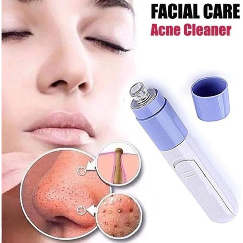 Skin Facial Pore Cleaner Blackhead Spot Zit Acne Remover Keimav ...