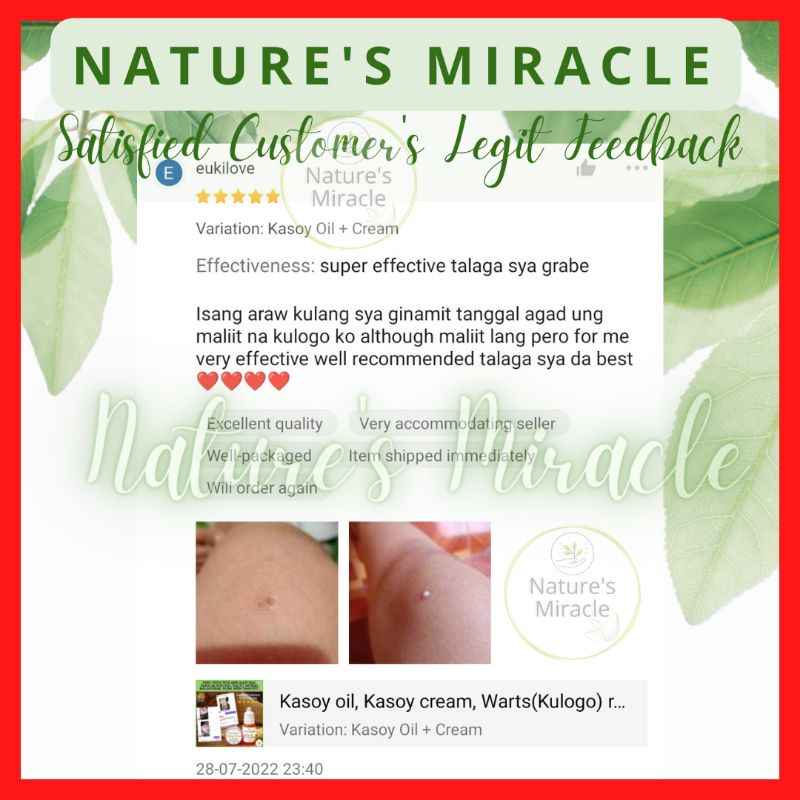 Natures Miracle Kasoy Oil Organic & Effective Wart Remover Kulugo Mole ...