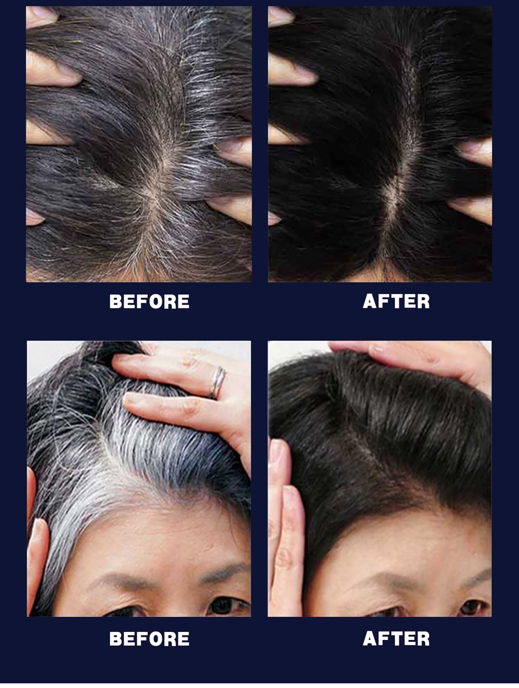 FAIRKING Hairline Concealer Cream Filling Pen Covers White Hair Roots ...